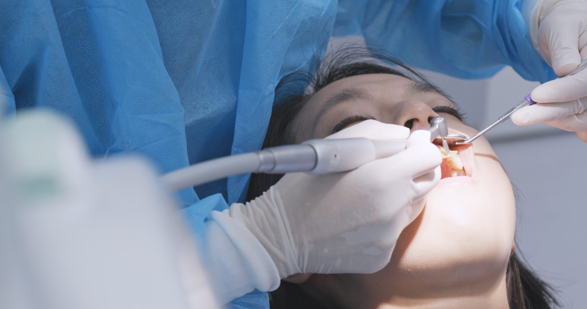 Rellenos Dentales | Porthuenemedentist.com
